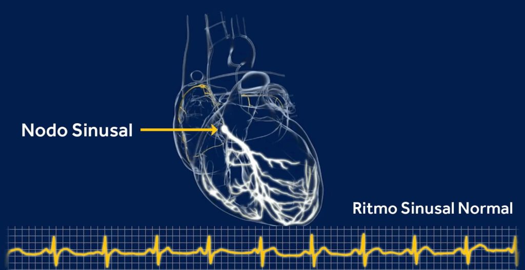 Enfermedades Cardiovasculares comunes y los riesgos adicionales ...
